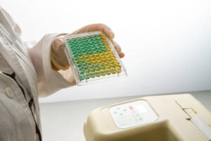 Size Exclusion Chromatography (SEC):Principles, Methods 2025